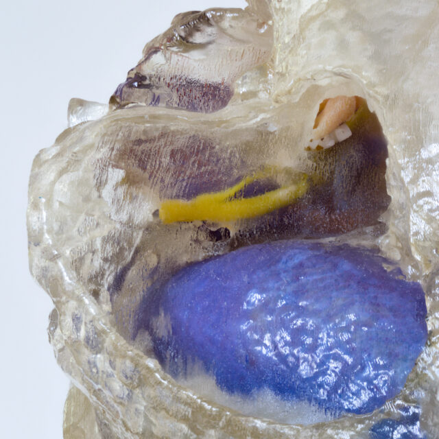VOXEL-MAN ENT – Virtual Surgery Simulator